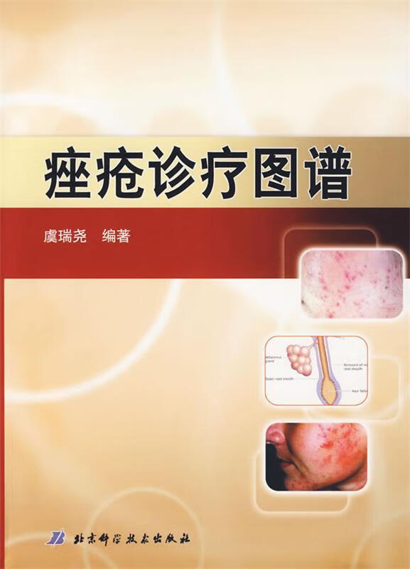 痤疮诊疗图谱 虞瑞尧 编著【书】