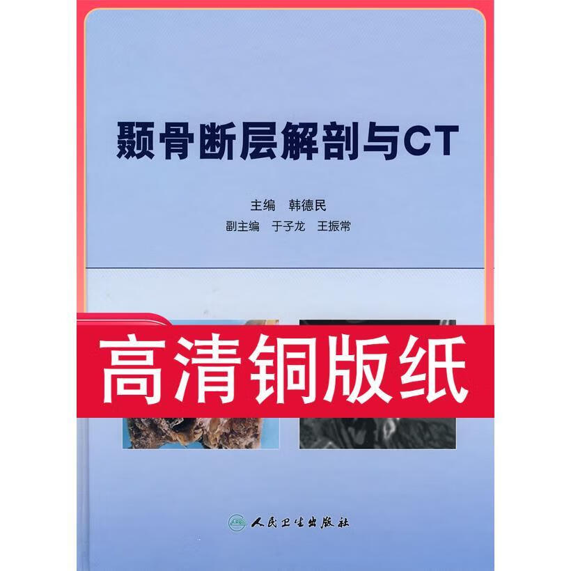 颞骨断层解剖与CT 铜版纸