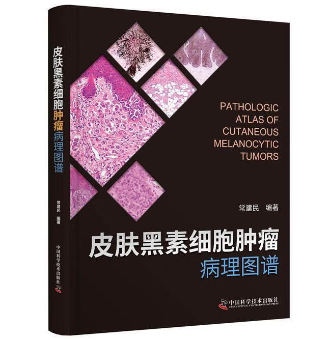 皮肤黑素细胞病理图谱 常建民 医学 9787504687586