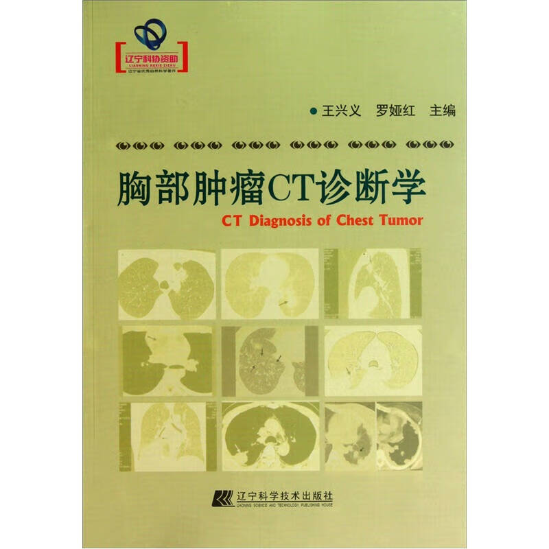 胸部肿瘤CT诊断学【特惠】