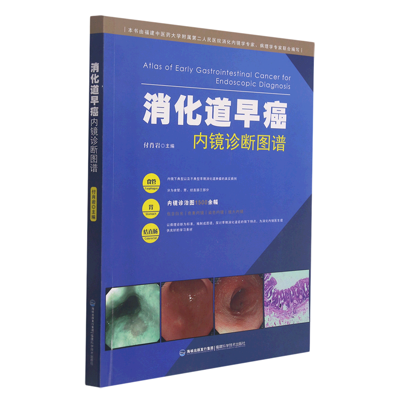 消化道早癌内镜诊断图谱