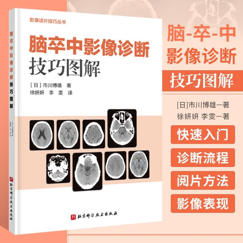 脑卒中影像诊断技巧图解 影像读片技巧丛书 脑部脑卒中影像诊断影像CT读片MRI技巧 脑部超声影像CT断层PET解剖 北京科学技术出版社 科学技术出版社9787571424657 医学书籍