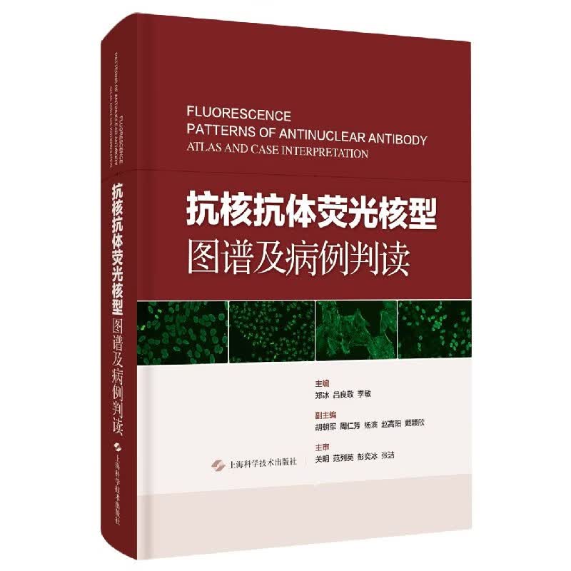 抗核抗体荧光核型图谱及病例判读(精)