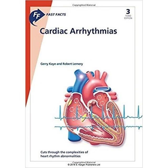 全彩实体Fast Facts: diac Arrhythmias, 3rd edition