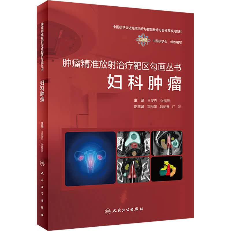 妇科肿瘤 图书