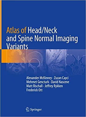 Atlas of Head/Neck and Spine Normal Imaging Vari
