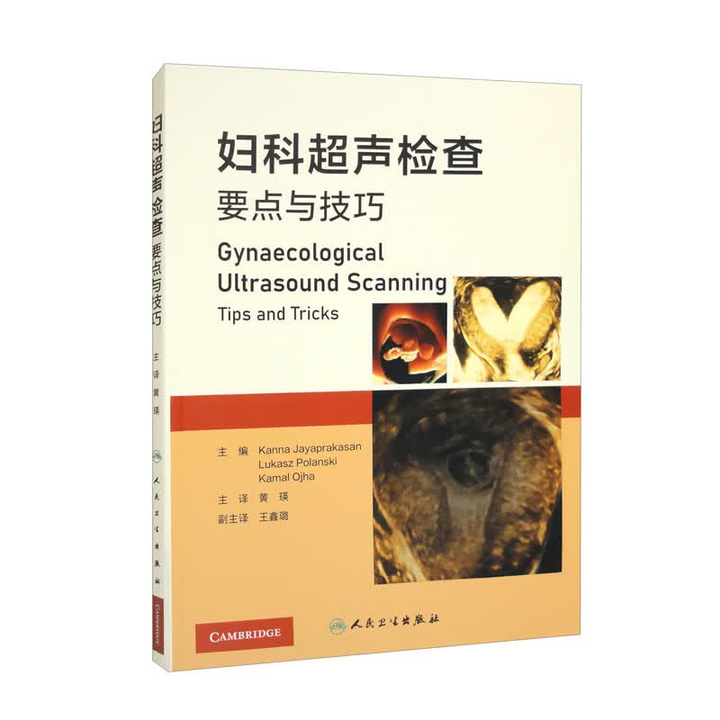妇科超声检查要点与技巧