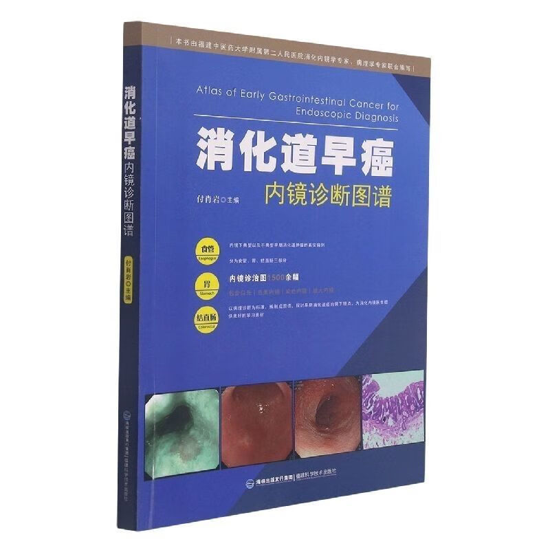 彩色 消化道早癌内镜诊断图谱