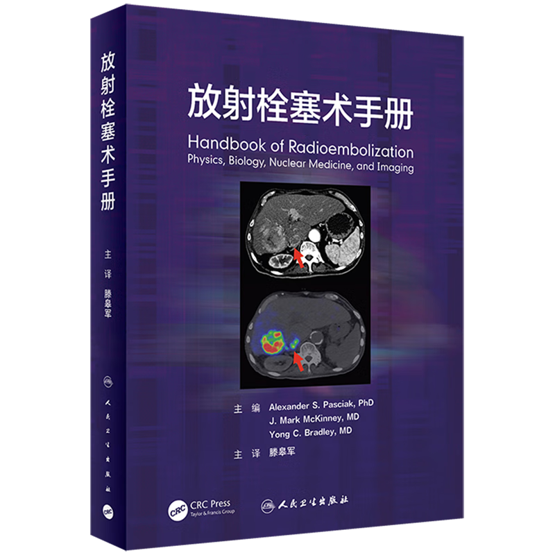 放射栓塞术手册(精)