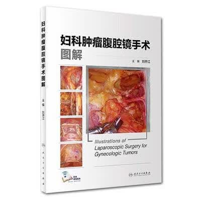 妇科肿瘤腹腔镜手术图解 刘开江 妇科腹腔镜手术学 人民卫生 妇科肿瘤腹腔镜手术图解