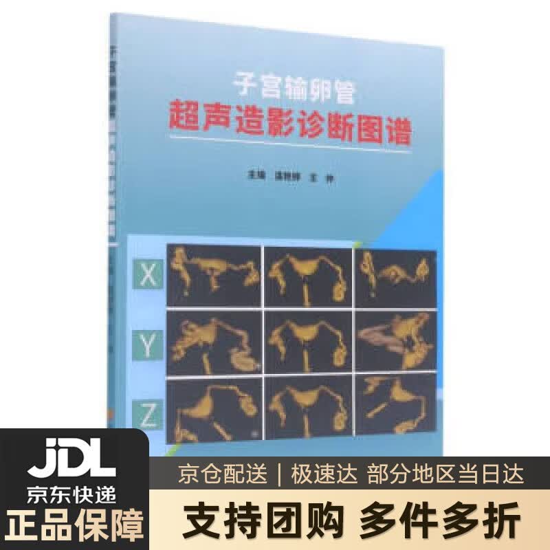 【 送货上门】子宫输卵管超声造影诊断图谱 温艳婷,王仲 编 四川科学技术出版社