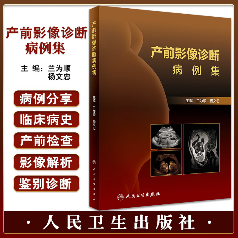 现货 产前影像诊断病例集 兰为顺 杨文忠主编 胎儿各系统先天畸形磁共振 典型图像诊断要点鉴别诊断 人民卫生出版社9787117333689
