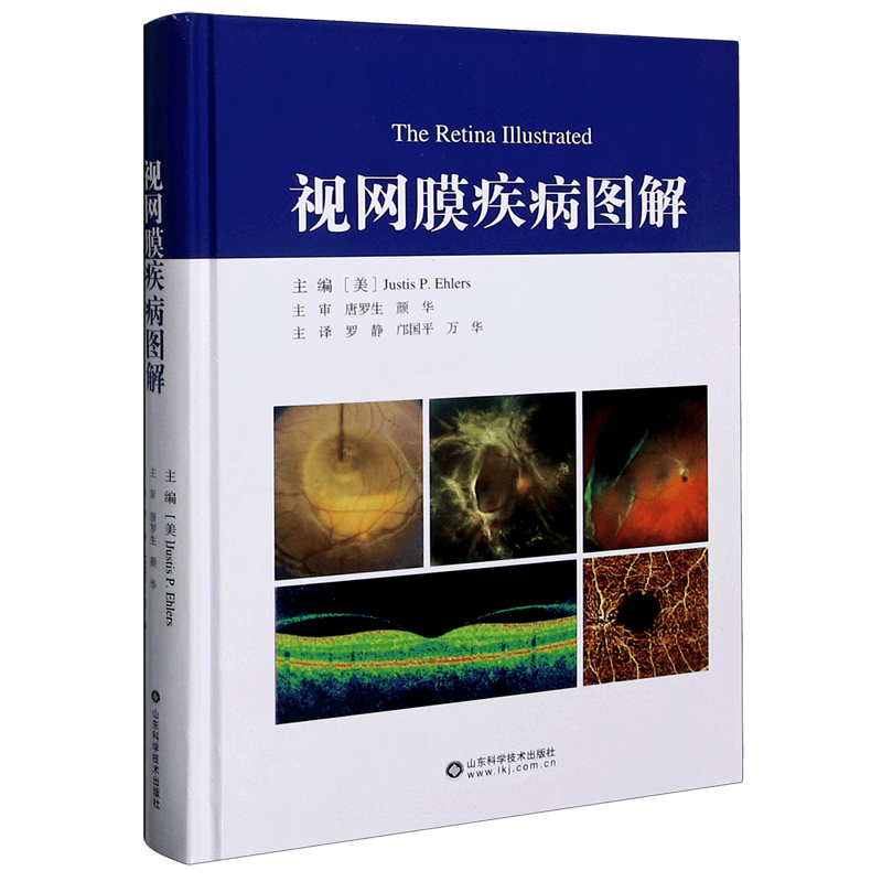 视网膜疾病图解(精)