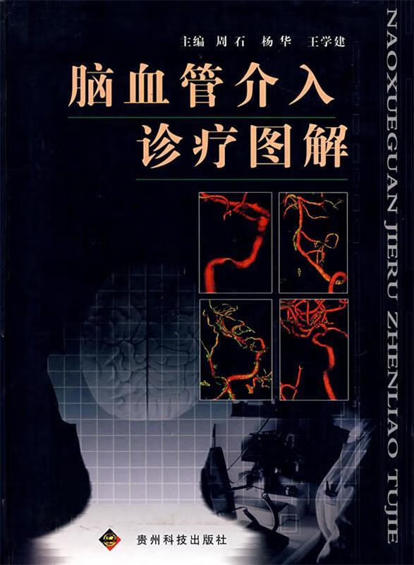 脑血管介入诊疗图解 周石,杨华,王学建 主编 贵州科技出版社