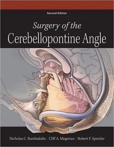 Surgery of the Cerebellopontine Angle