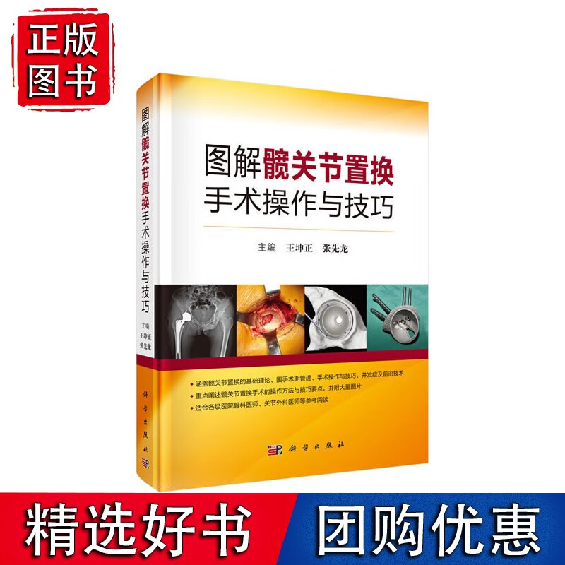 图解髋关节置换手术操作与技巧