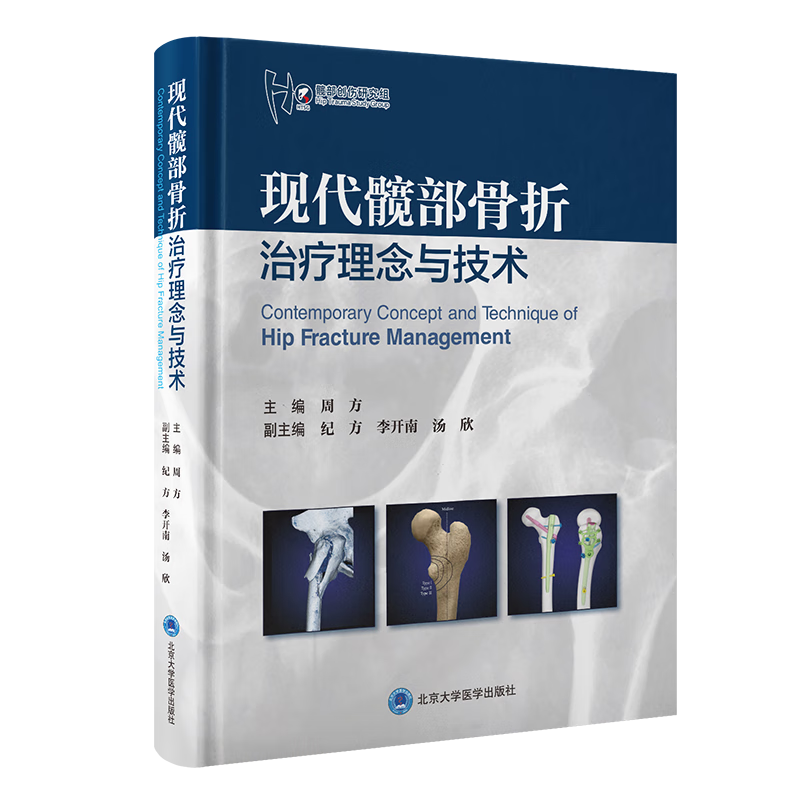 现代髋部骨折治疗理念与技术 9787565927423 北京大学医学出版社 临床骨科医师参考书 髋部骨折诊疗实用技术