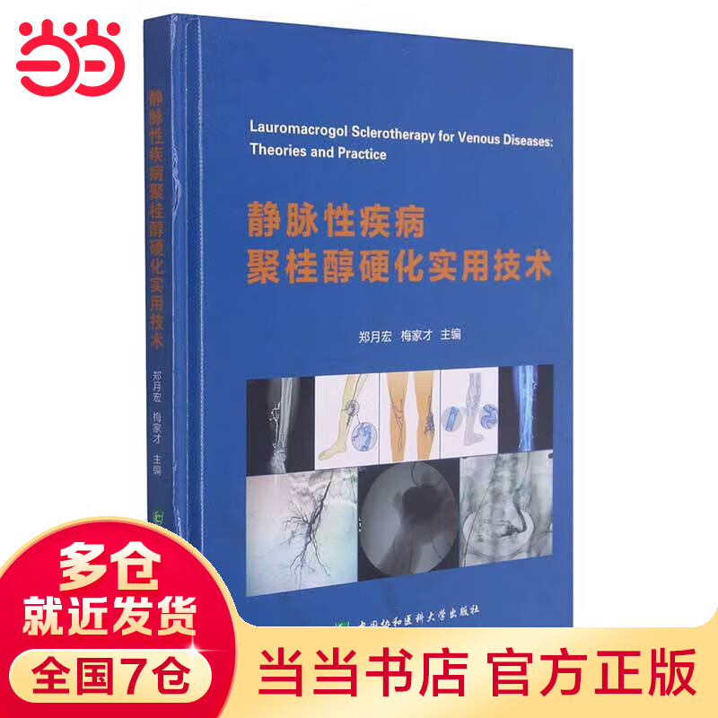 静脉性疾病聚桂醇硬化实用技术