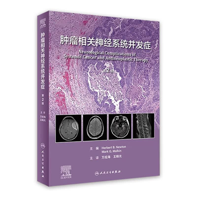 肿瘤相关神经系统并发症（第2版）9787117347471