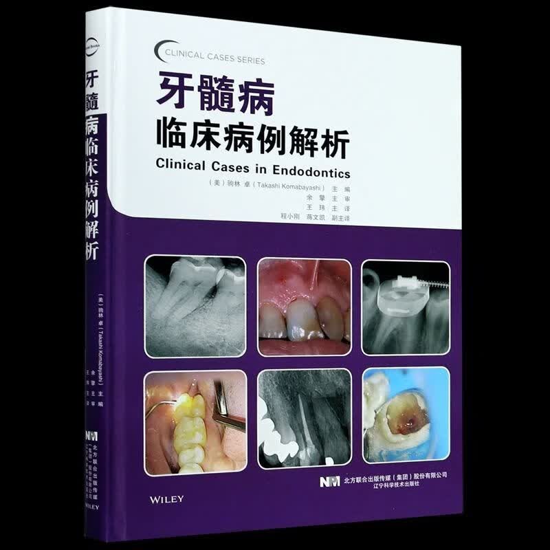 高清彩色 牙髓病临床病例解析