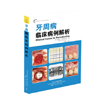 牙周病临床病例解析 Nadeem Karimbux【书】