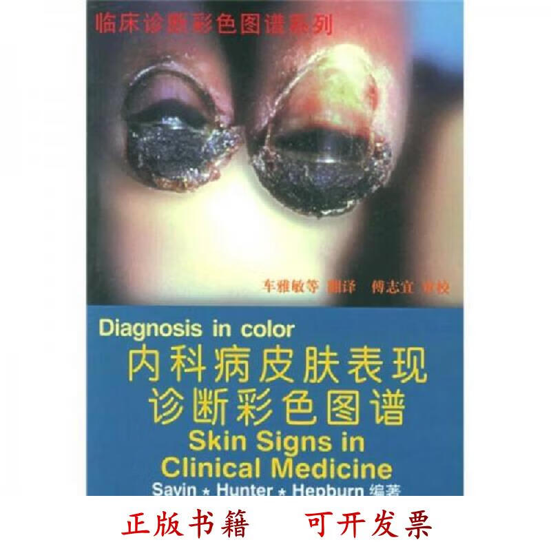内科病皮肤表现诊断彩色图谱 [英]塞文（Savin）、[英]塞文（Savin） 天津科技翻译出版公司 9787