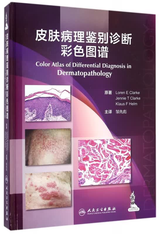 皮肤病理鉴别诊断彩色图谱(精)