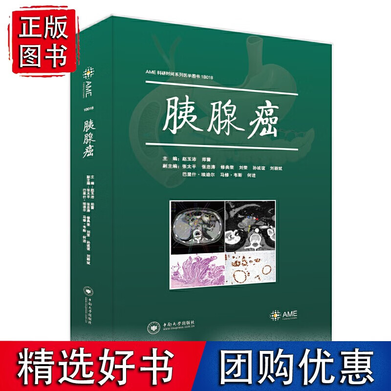 胰腺癌(AME科研时间系列医学)