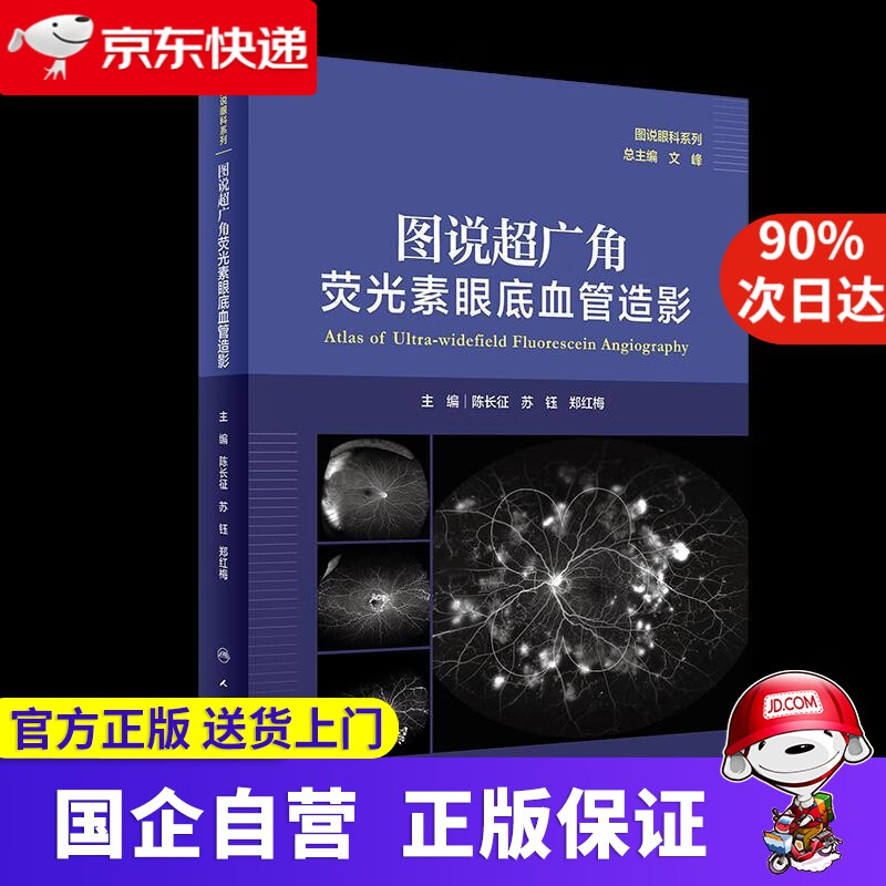 图说超广角荧光素眼底血管造影