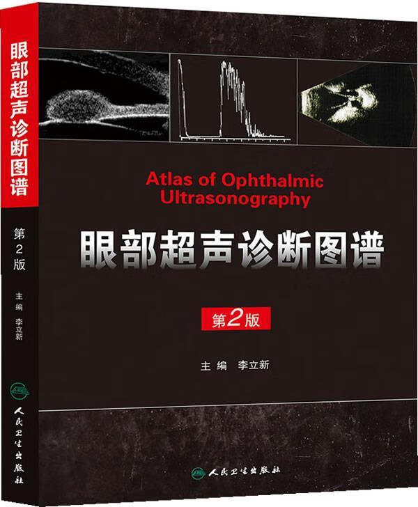 眼部超声诊断图谱
