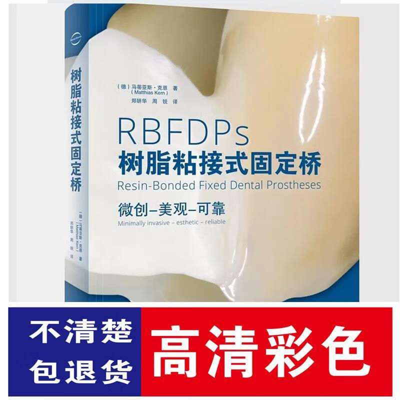 树脂粘接式固定桥