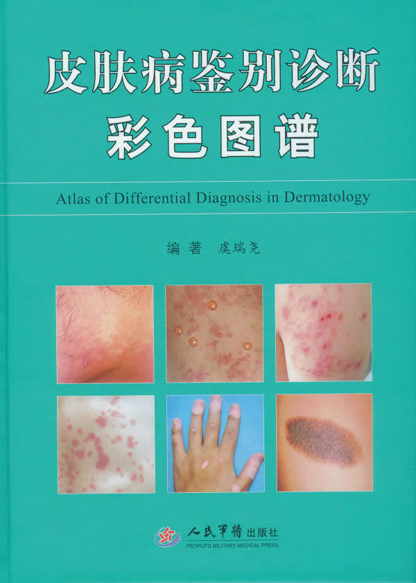 皮肤病鉴别诊断彩色图谱 虞瑞尧编著【书】