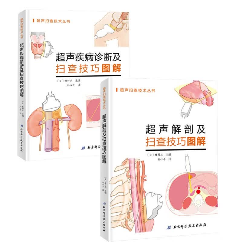 超声解剖及扫查技巧图解+超声疾病诊断及扫查技巧图解 全2册 超声扫查技术丛书超声医学规培教材书籍超声