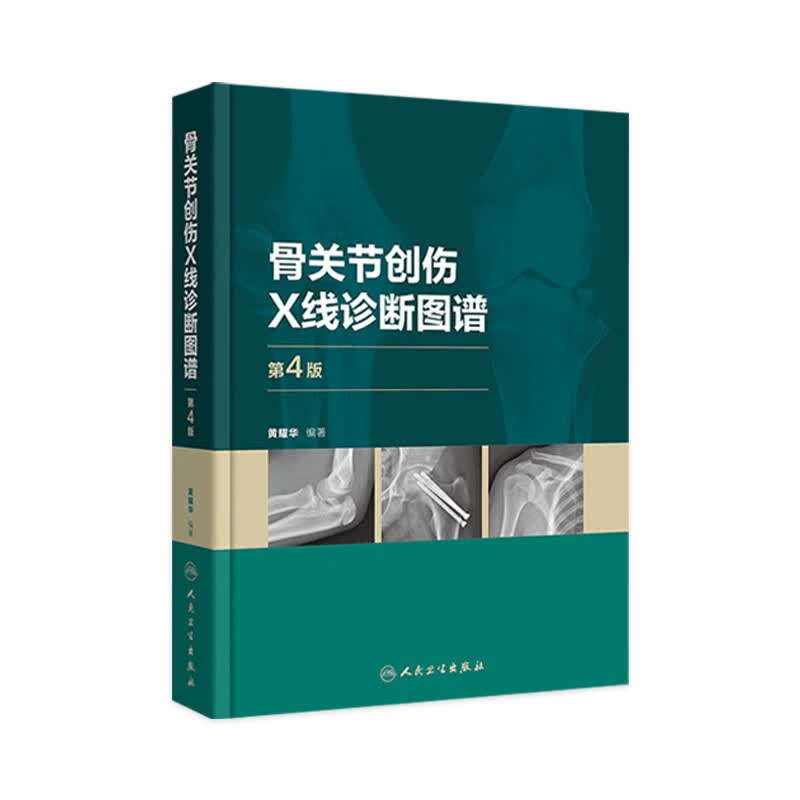 骨关节创伤X线诊断图谱（第4版） 9787117328548