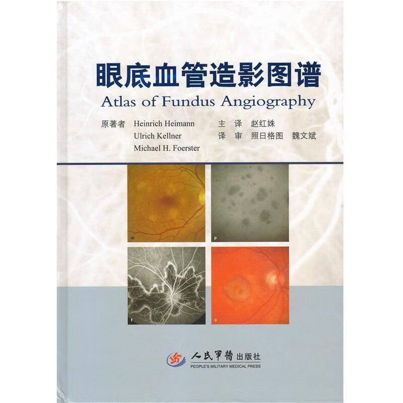 眼底血管造影图谱【，放心购买】