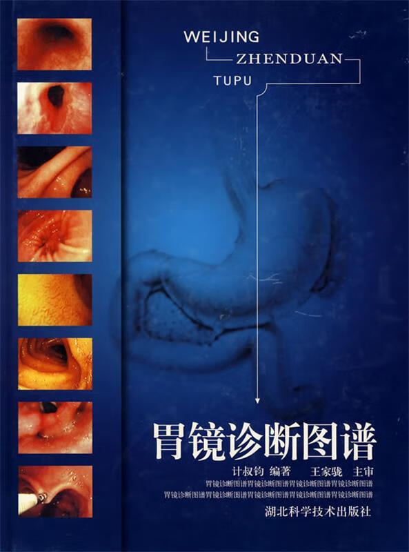 胃镜诊断图谱