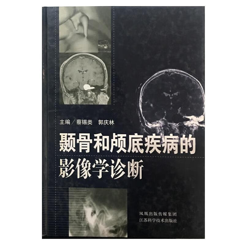 颞骨和颅底疾病的影像学诊断【好书，下单速发】