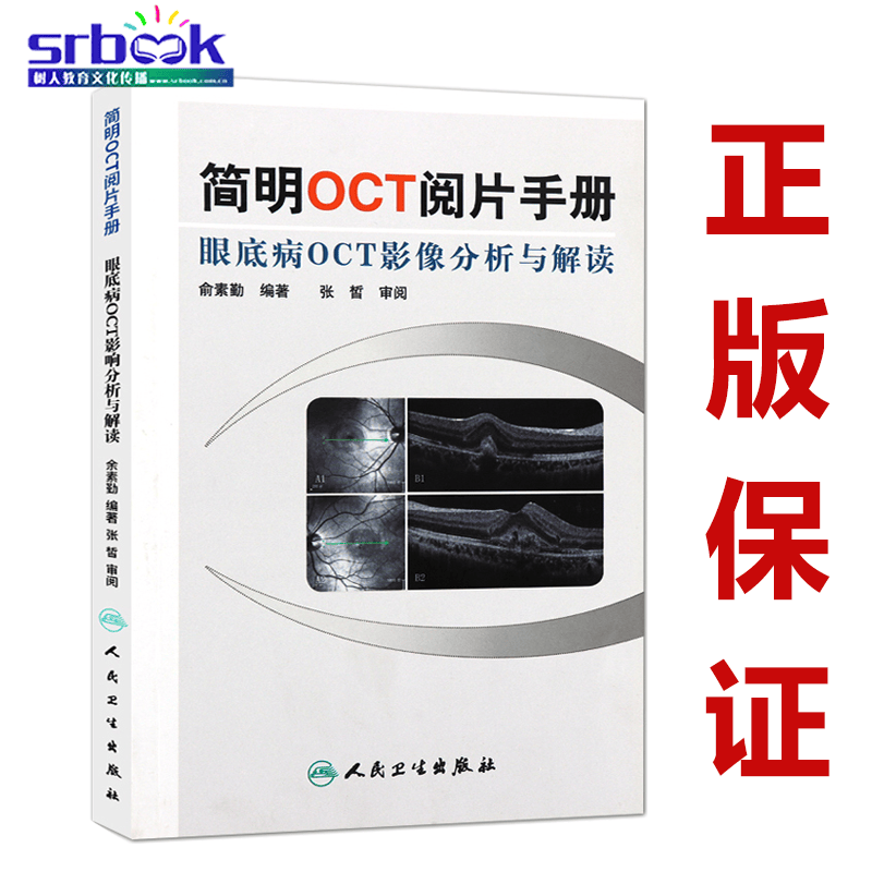 简明OCT阅片手册眼底病OCT影像分析与解读 俞素勤 编著 人民卫生出版社 眼科医生的口袋书