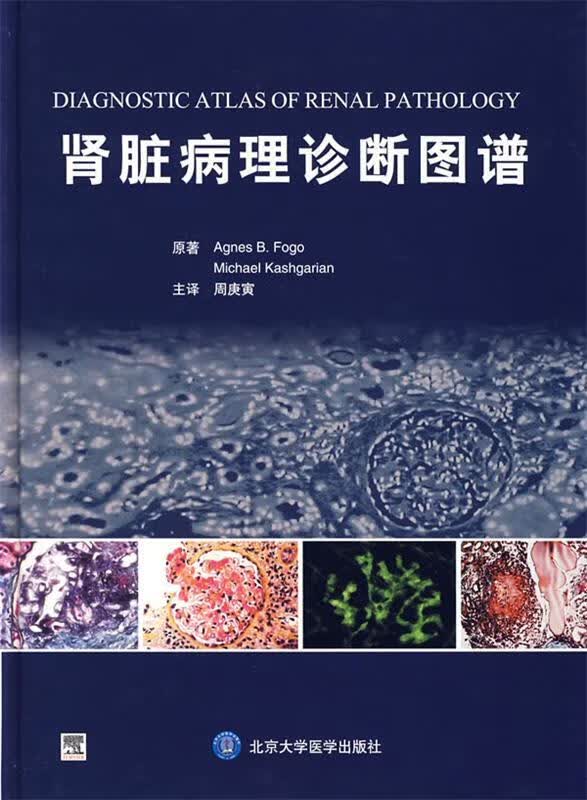 肾脏病理诊断图谱 福戈,卡什加里安著,周庚寅主译【书】