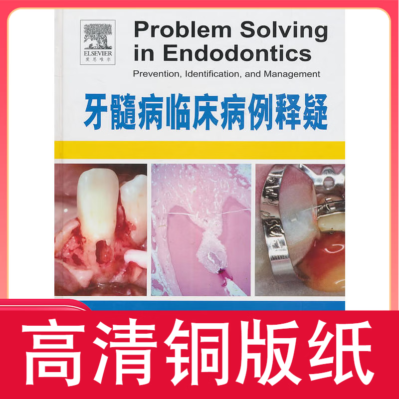 牙髓病临床病例释疑 110克激光纸