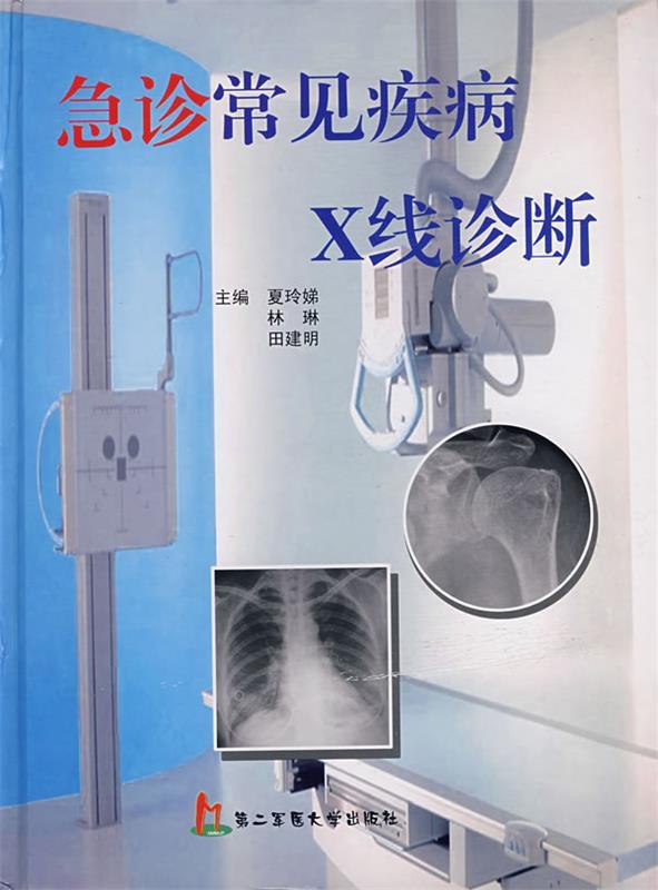 急诊常见疾病X线诊断