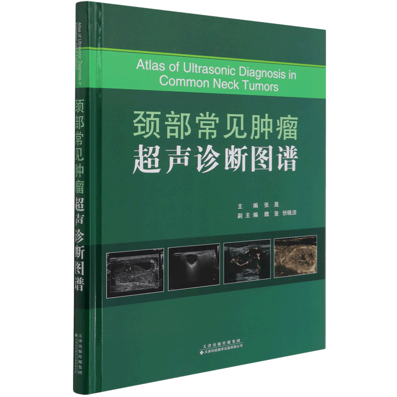 颈部常见肿瘤超声诊断图谱(精)