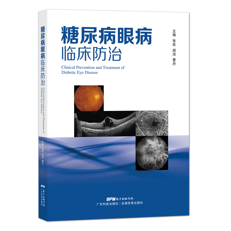 糖尿病眼病临床防治