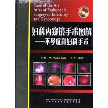 妇科内窥镜手术图解：不孕症和妇科手术 [印度]杰恩,岳天孚 天津科技翻译出版公司