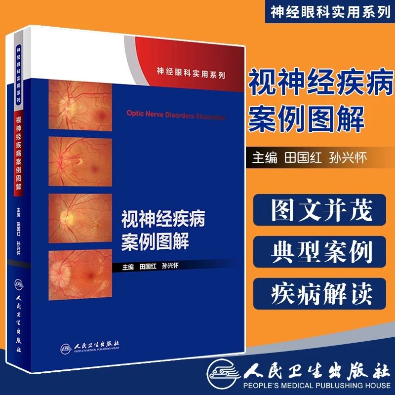 视神经疾病案例图解神经眼科实用系列田国红孙兴怀视神经发育异常炎缺血皮质盲视神经疾病眼底病青光眼学科医