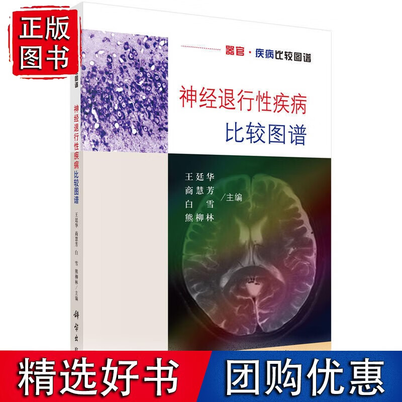 神经退行性疾病比较图谱