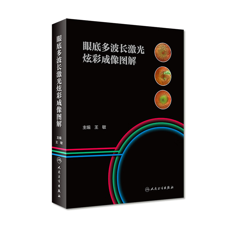 眼底多波长激光炫彩成像图解
