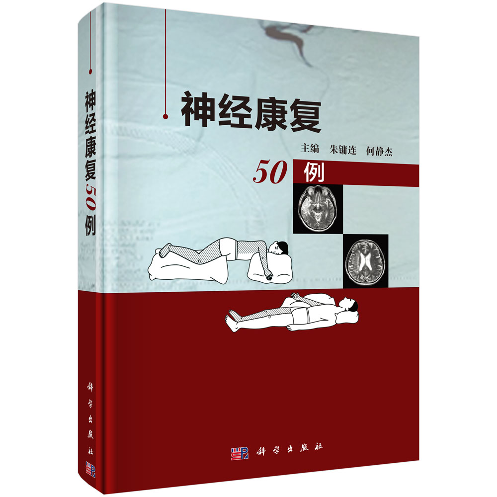 神经康复50例