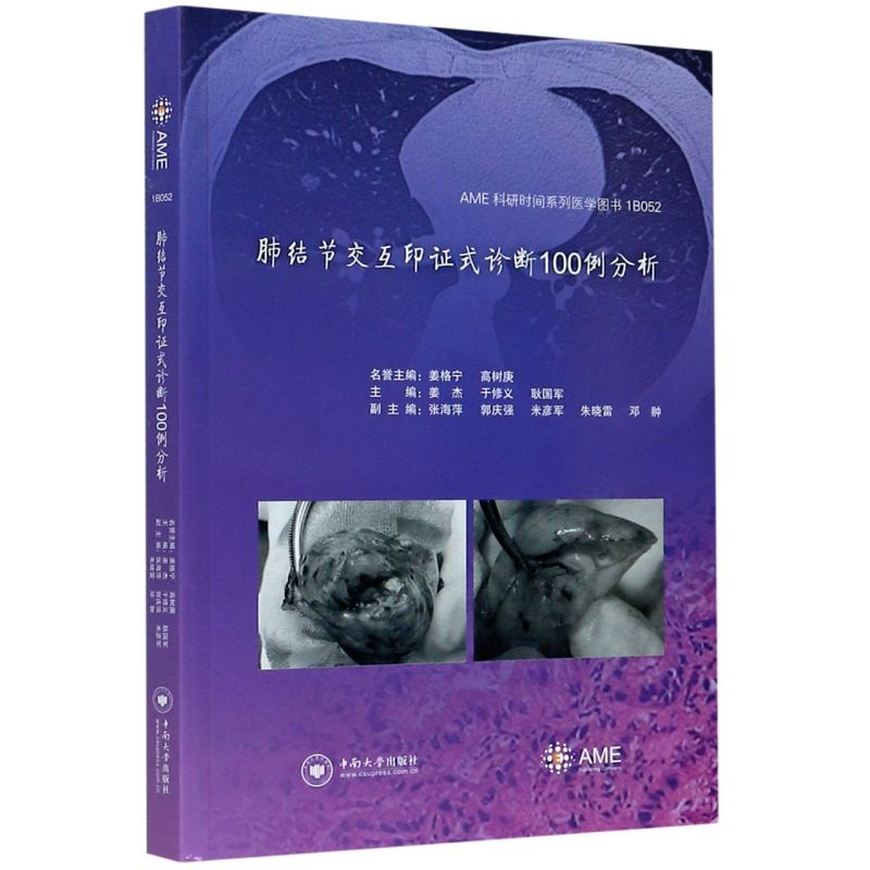 肺结节交互印证式诊断100例分析 姜杰于修义主编 胸外科诊治指南 胸部CT详解书籍 肺部肿瘤治疗策略