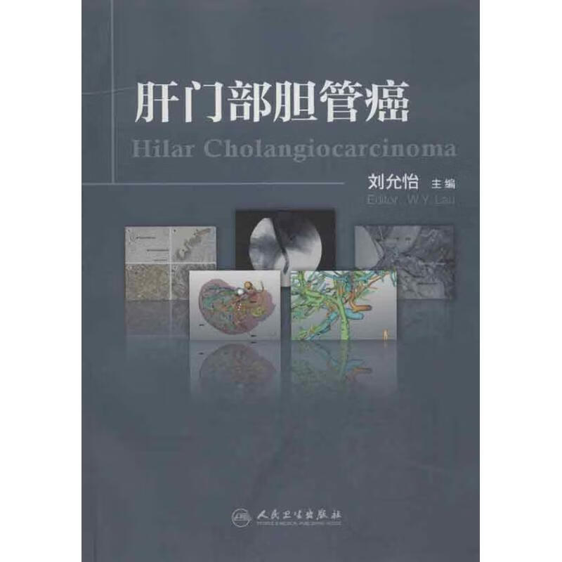 肝门部胆管癌